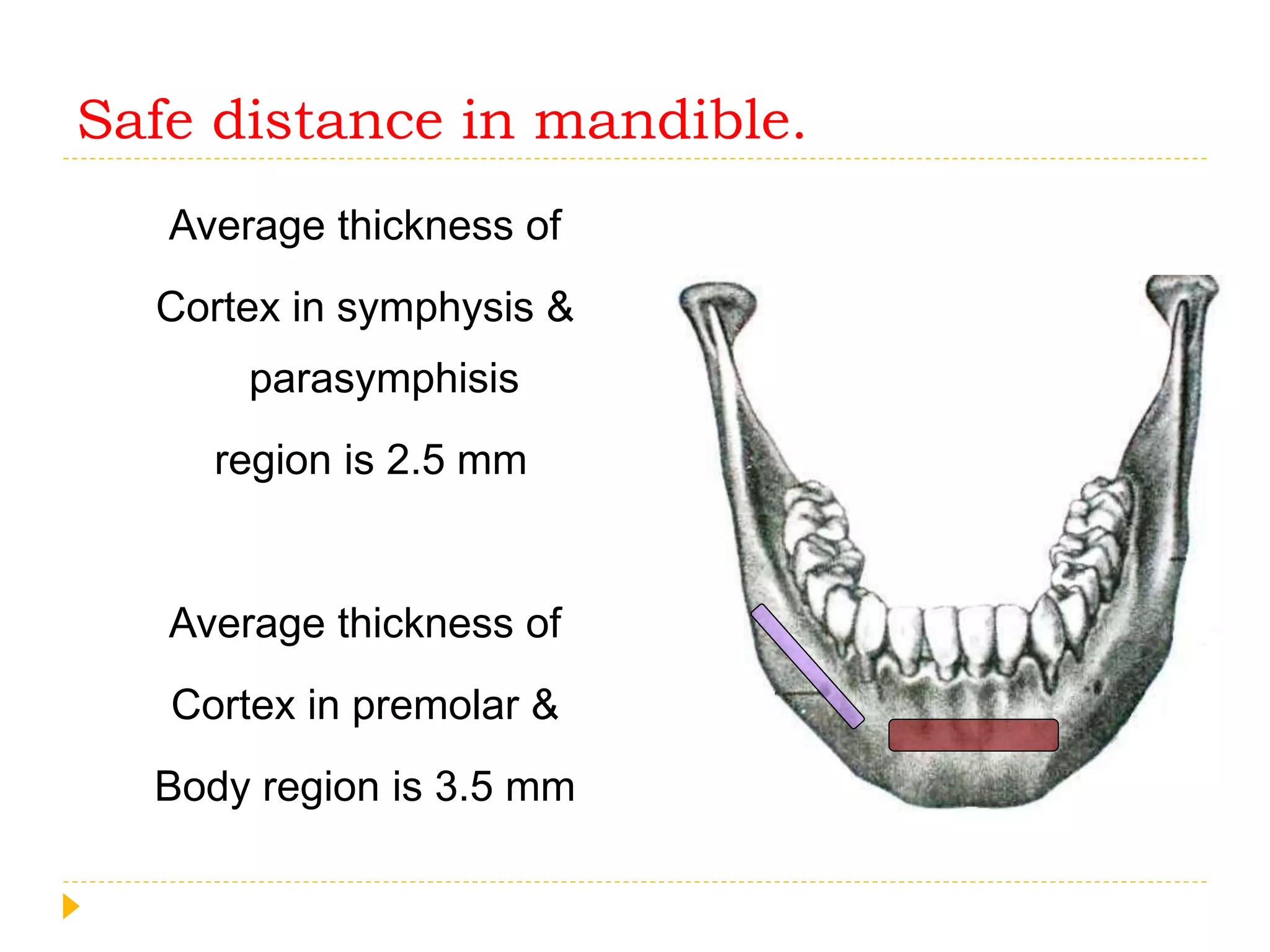 Mandibular fractures | PPTX