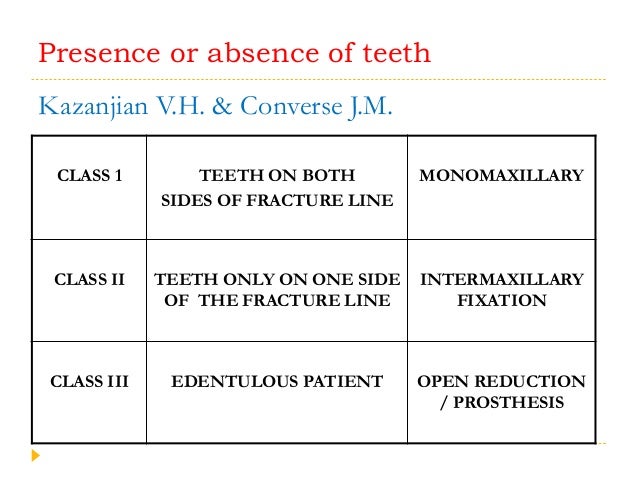 Mandible Fracture Classification Alila Medical Media | Mandibular