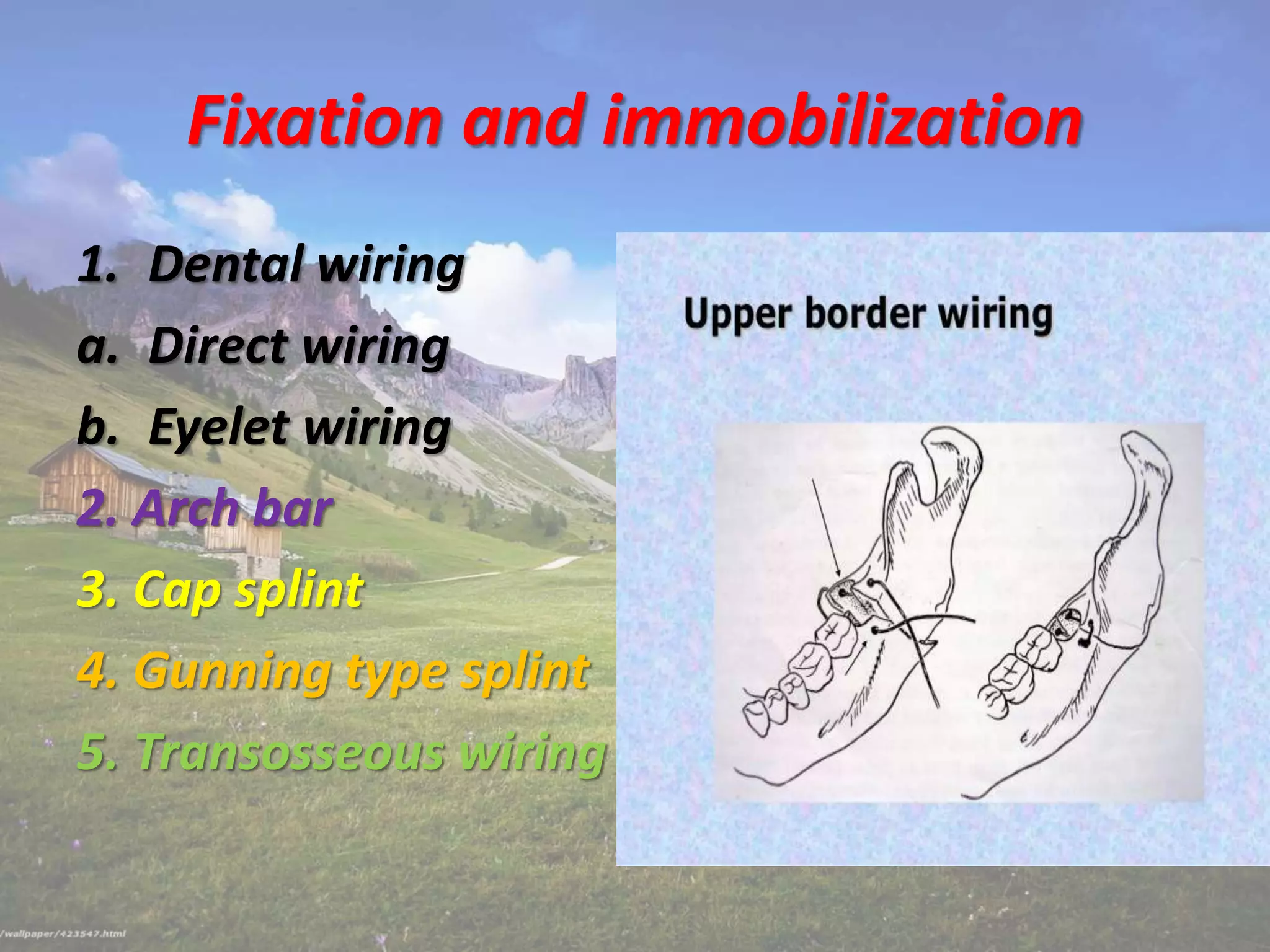 Mandibular fracture | PPSX