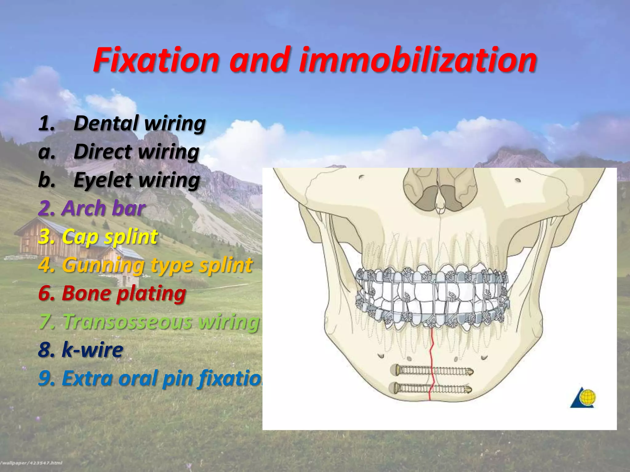 Mandibular fracture | PPSX
