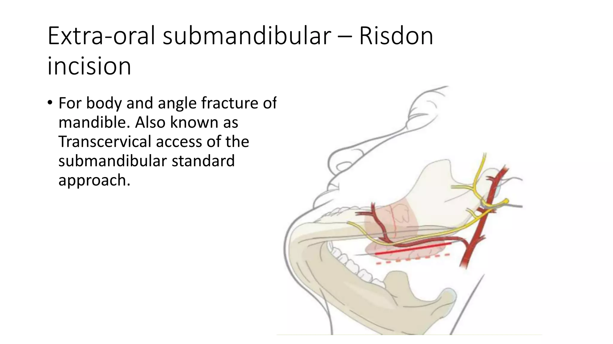 Mandibular fracture- diagnosis | PPTX