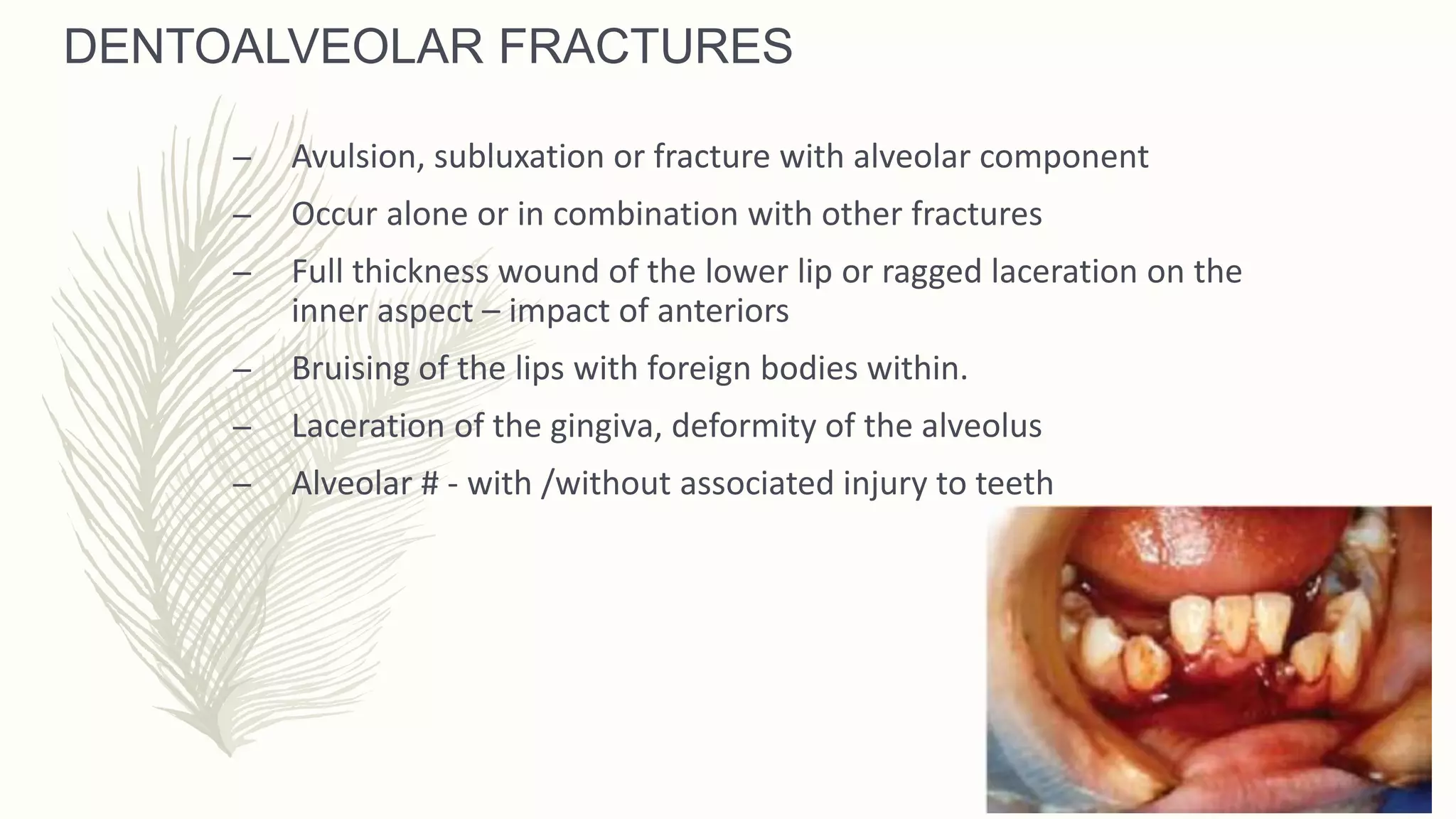 Mandibular Fracture.ppt