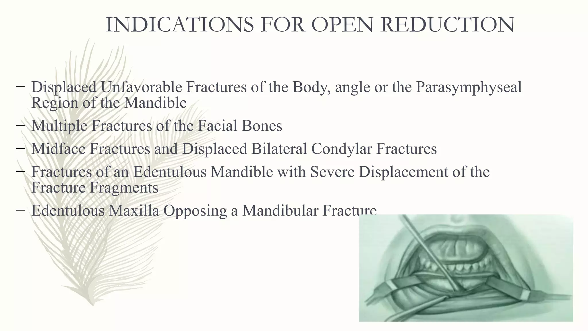 Mandibular Fracture.ppt
