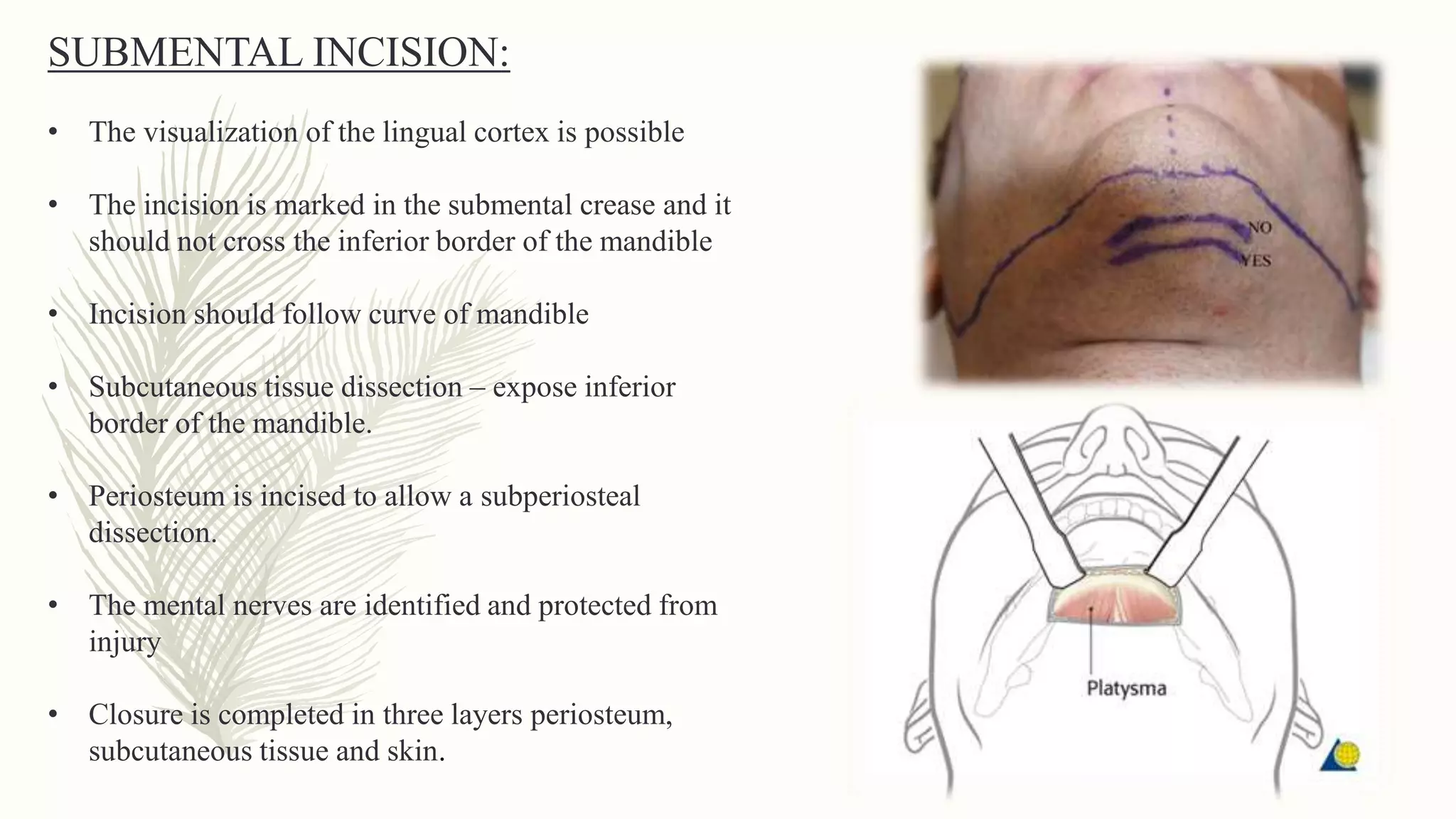 Mandibular Fracture.ppt