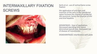 Mandibular Fracture.ppt