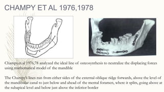 Mandibular Fracture.ppt