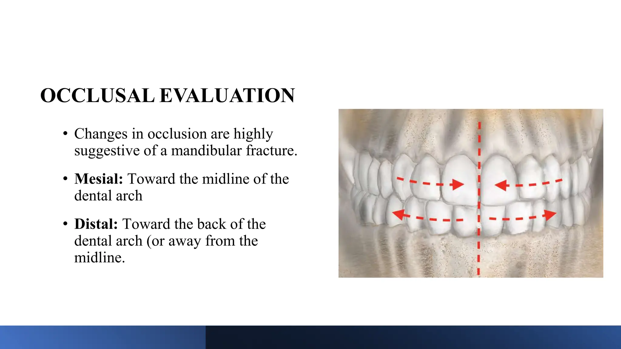MANDIBULAR FRACTURE in plastic surgery.pptx
