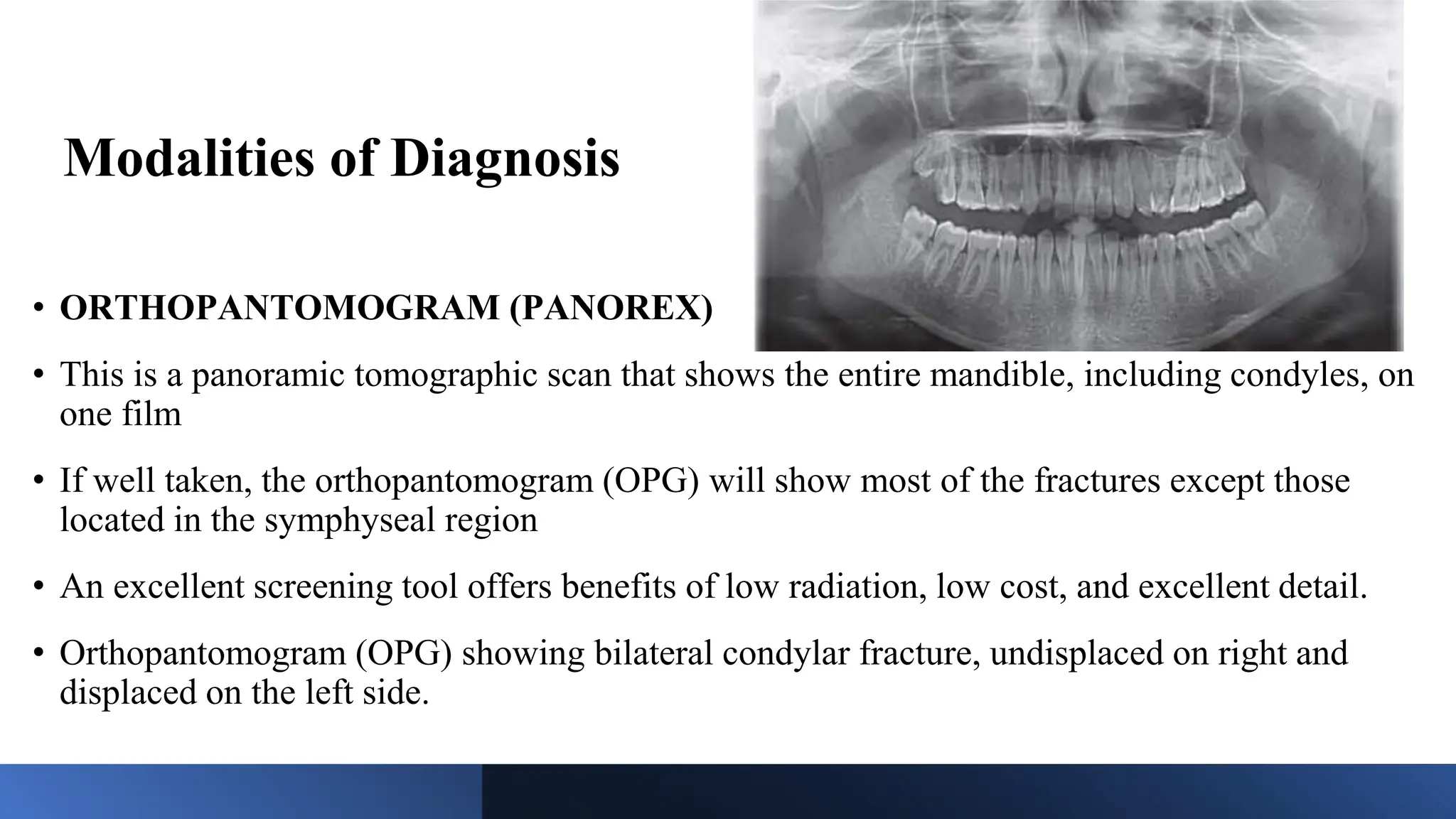 MANDIBULAR FRACTURE in plastic surgery.pptx