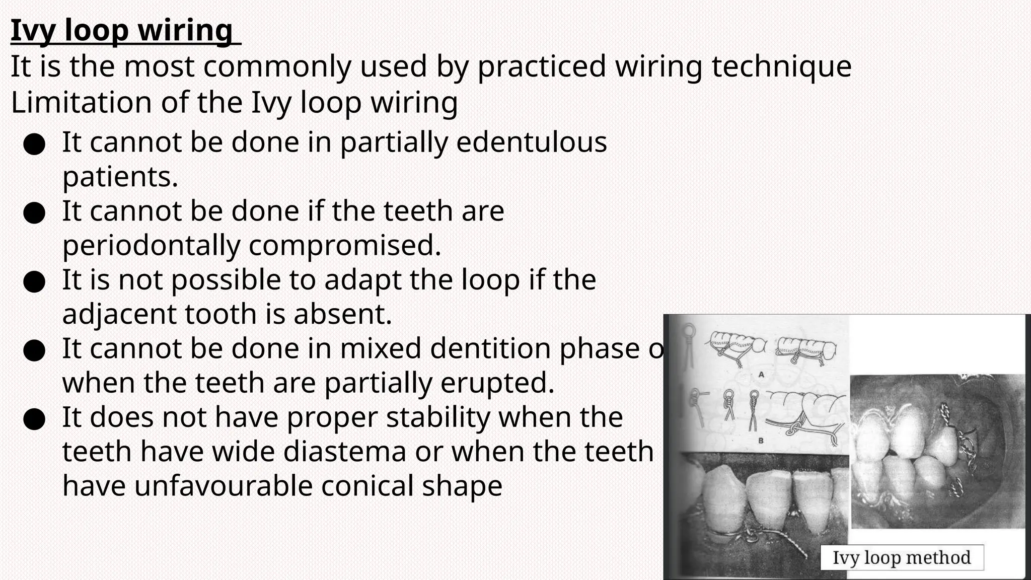 mandibular fracture_ chsdft aswiyshs.pptx