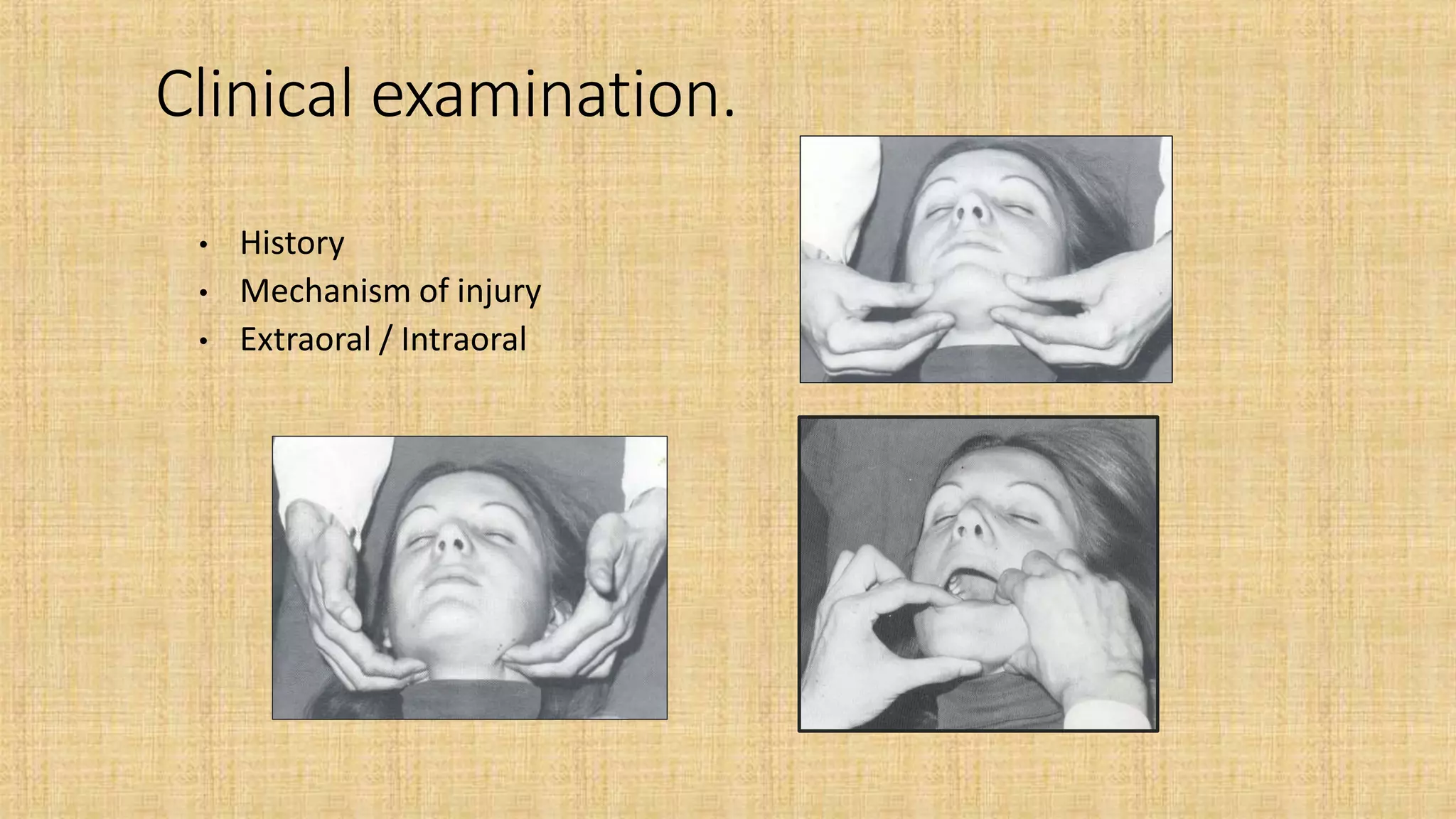 Mandibular fracture closed reduction | PPT