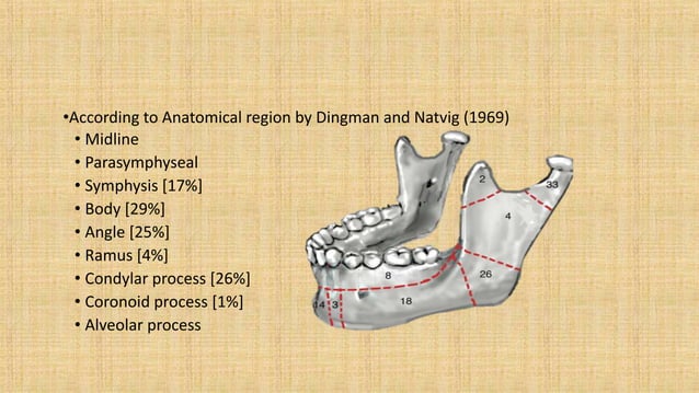 Mandibular fracture closed reduction | PPT