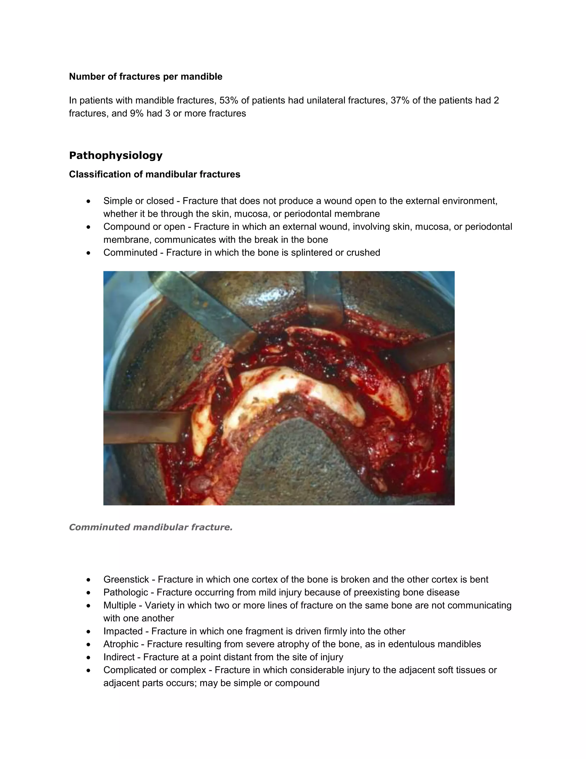 Mandibular fractures | DOCX