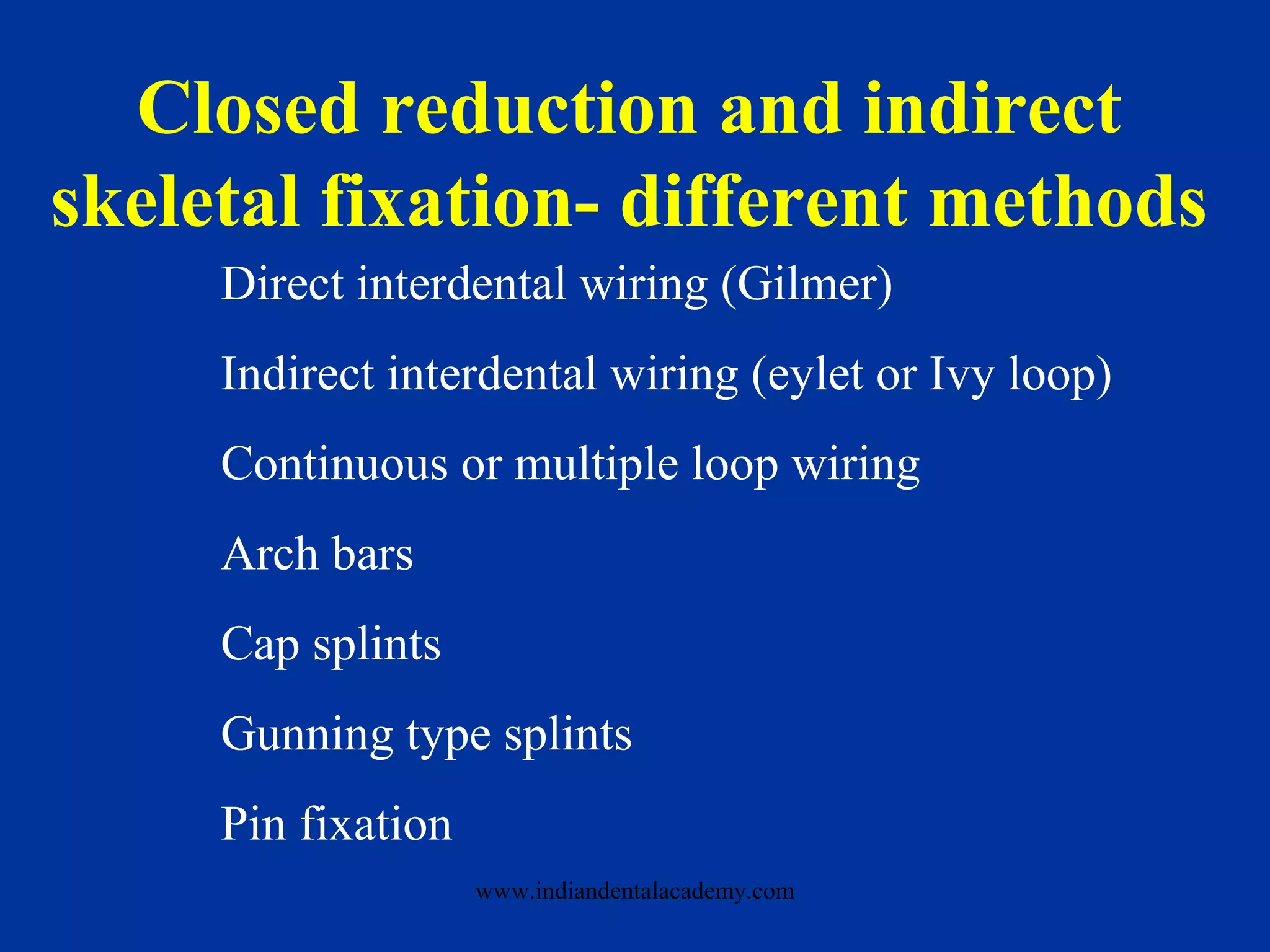 Mandibular fractures / oral surgery courses | PPT