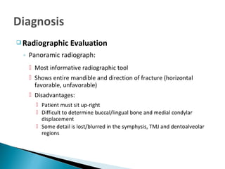 Mandibular fractures | PPT