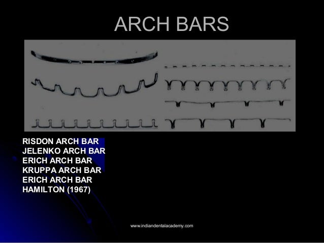 Mandibular fractures 1 / fixed orthodontic courses