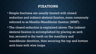 MANDIBULAR FRACTURES. . | PPTX
