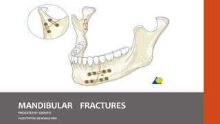 MANDIBULAR FRACTURES MANAGEMENT PROTOCO | PPTX