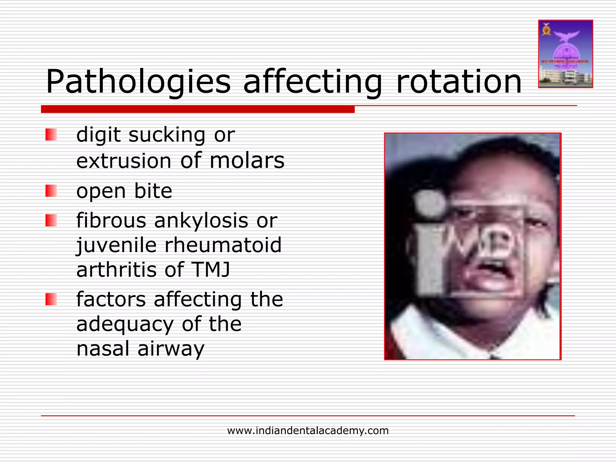 Mandibular growth rotation (2)/certified fixed orthodontic courses by ...