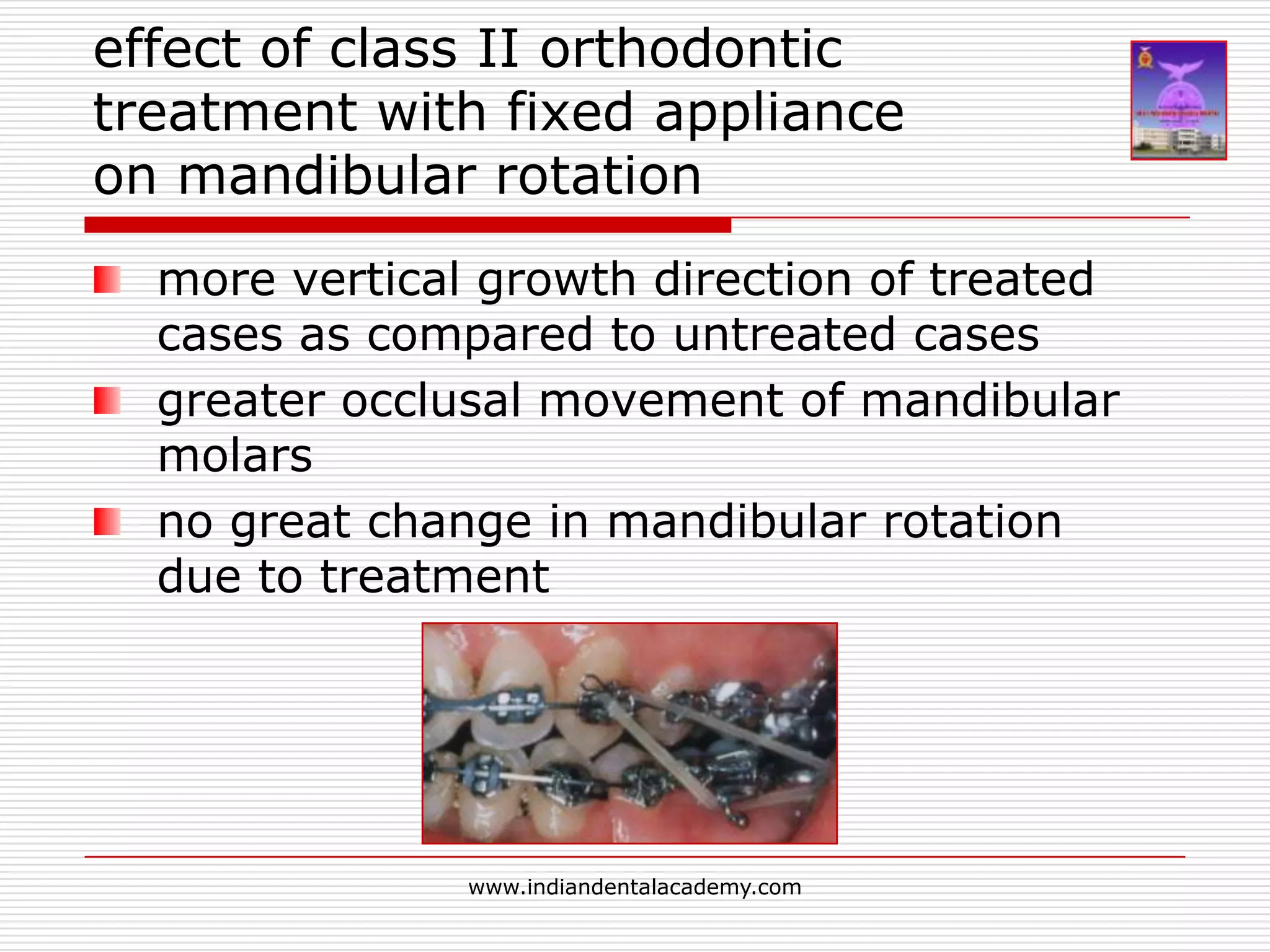 Mandibular growth rotation (2)/certified fixed orthodontic courses by ...