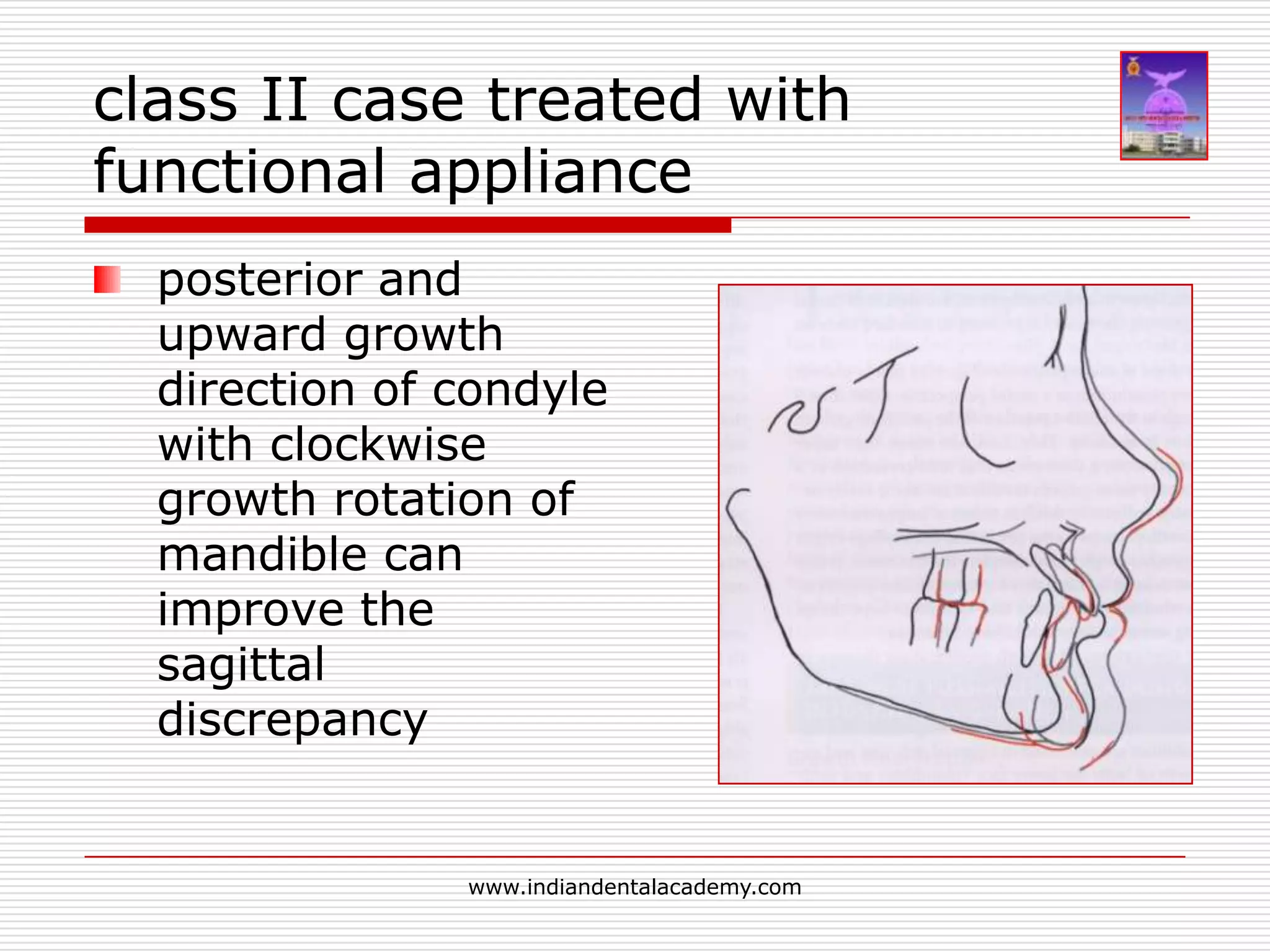 Mandibular growth rotation (2)/certified fixed orthodontic courses by ...