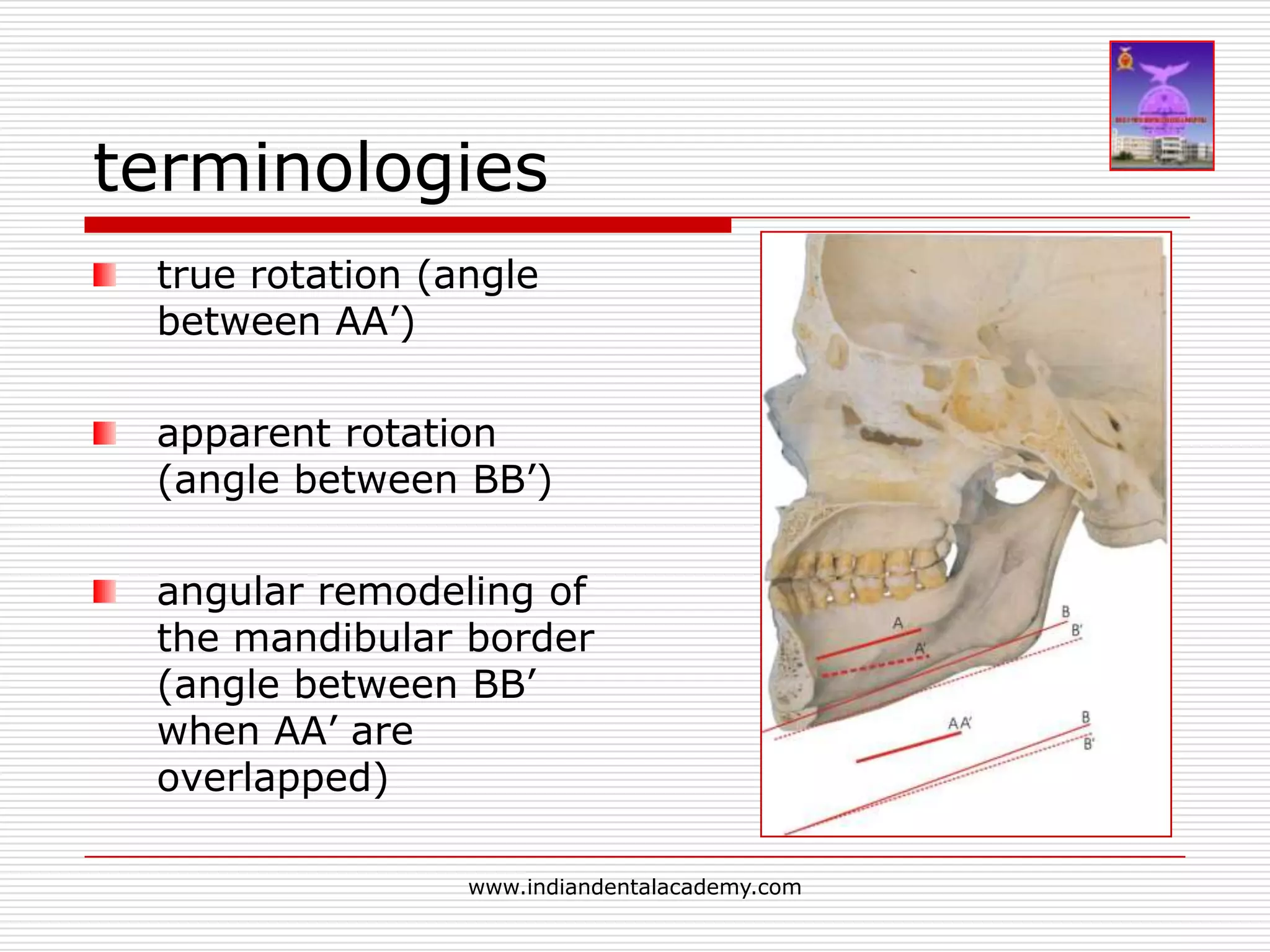 Mandibular growth rotation (2)/certified fixed orthodontic courses by ...