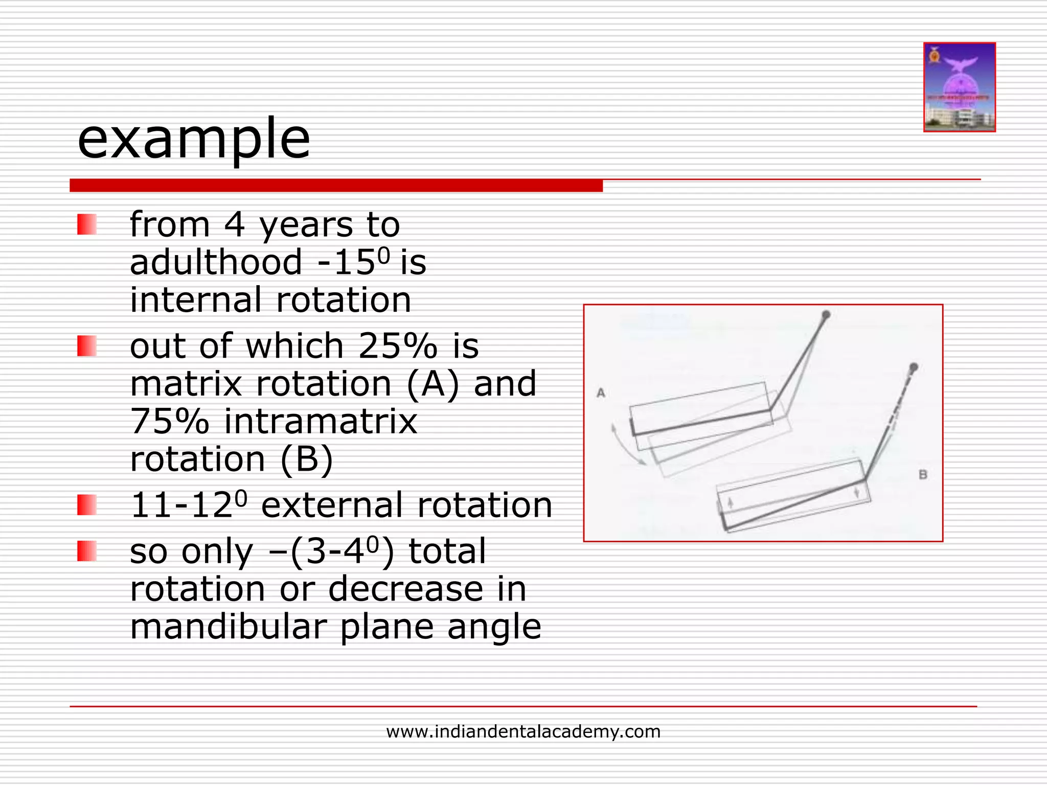 Mandibular growth rotation (2)/certified fixed orthodontic courses by ...