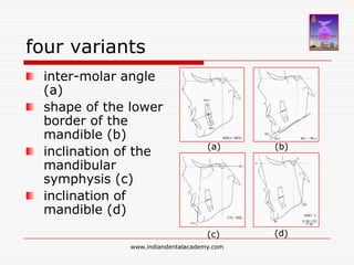 Mandibular growth rotation (2)/certified fixed orthodontic courses by ...