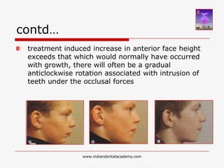 Mandibular growth rotation (2)/certified fixed orthodontic courses by ...