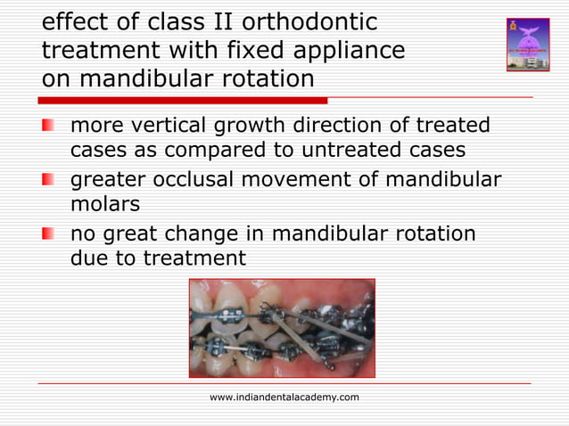 Mandibular growth rotation (2)/certified fixed orthodontic courses by ...