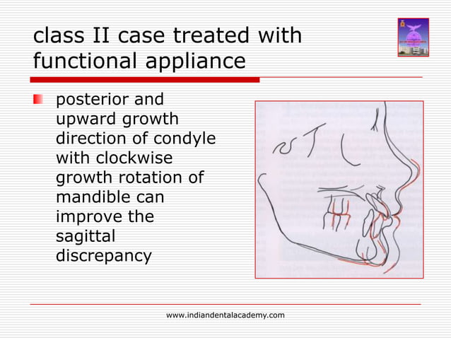 Mandibular growth rotation (2)/certified fixed orthodontic courses by ...