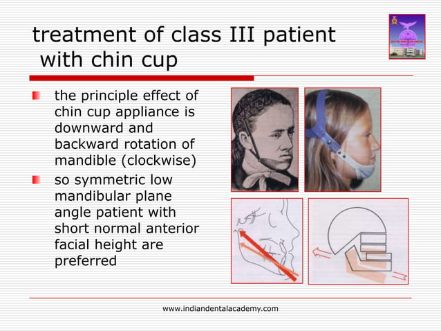 Mandibular growth rotation (2)/certified fixed orthodontic courses by ...