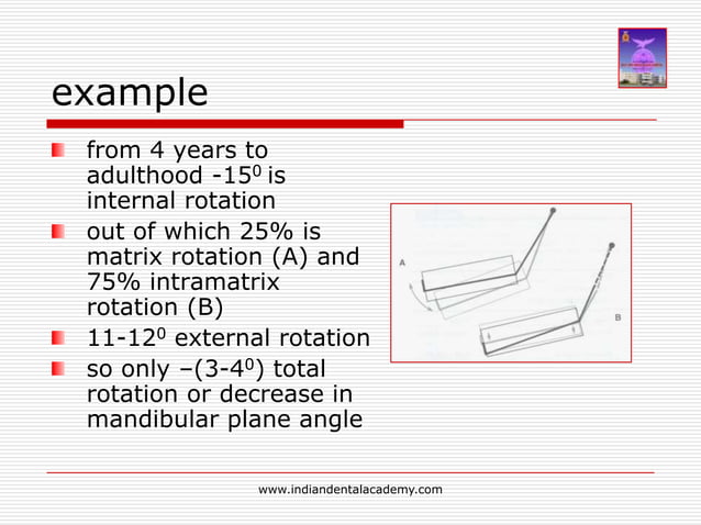 Mandibular growth rotation (2)/certified fixed orthodontic courses by ...