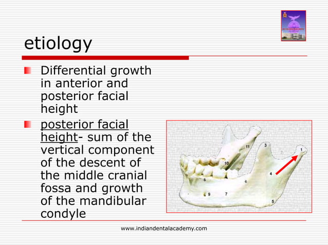 Mandibular growth rotation (2)/certified fixed orthodontic courses by ...