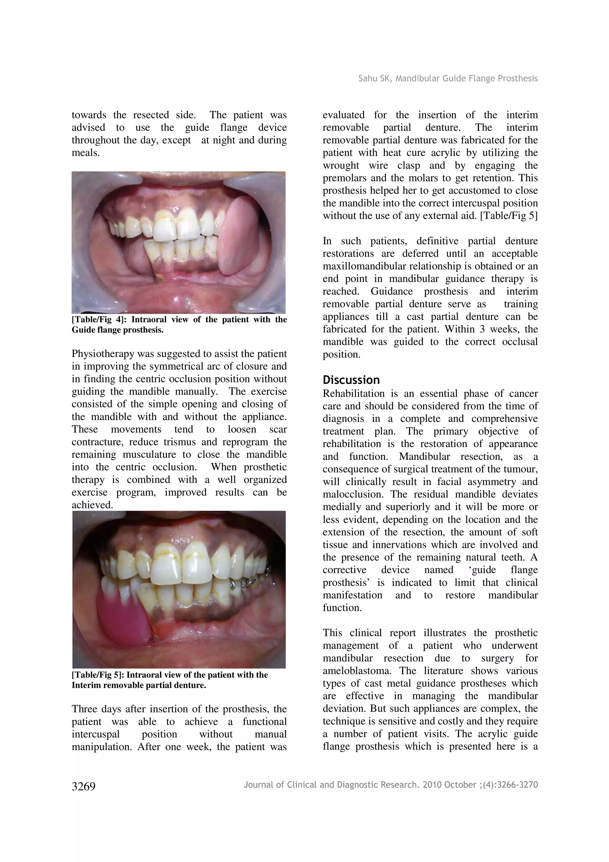 Mandibular guidance 3 | PDF