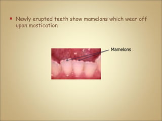 Mandibular Incisors | PPT