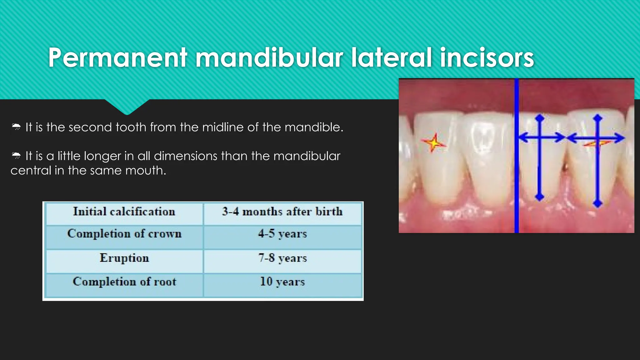 The morphology of permanent mandibular incisors | PPTX