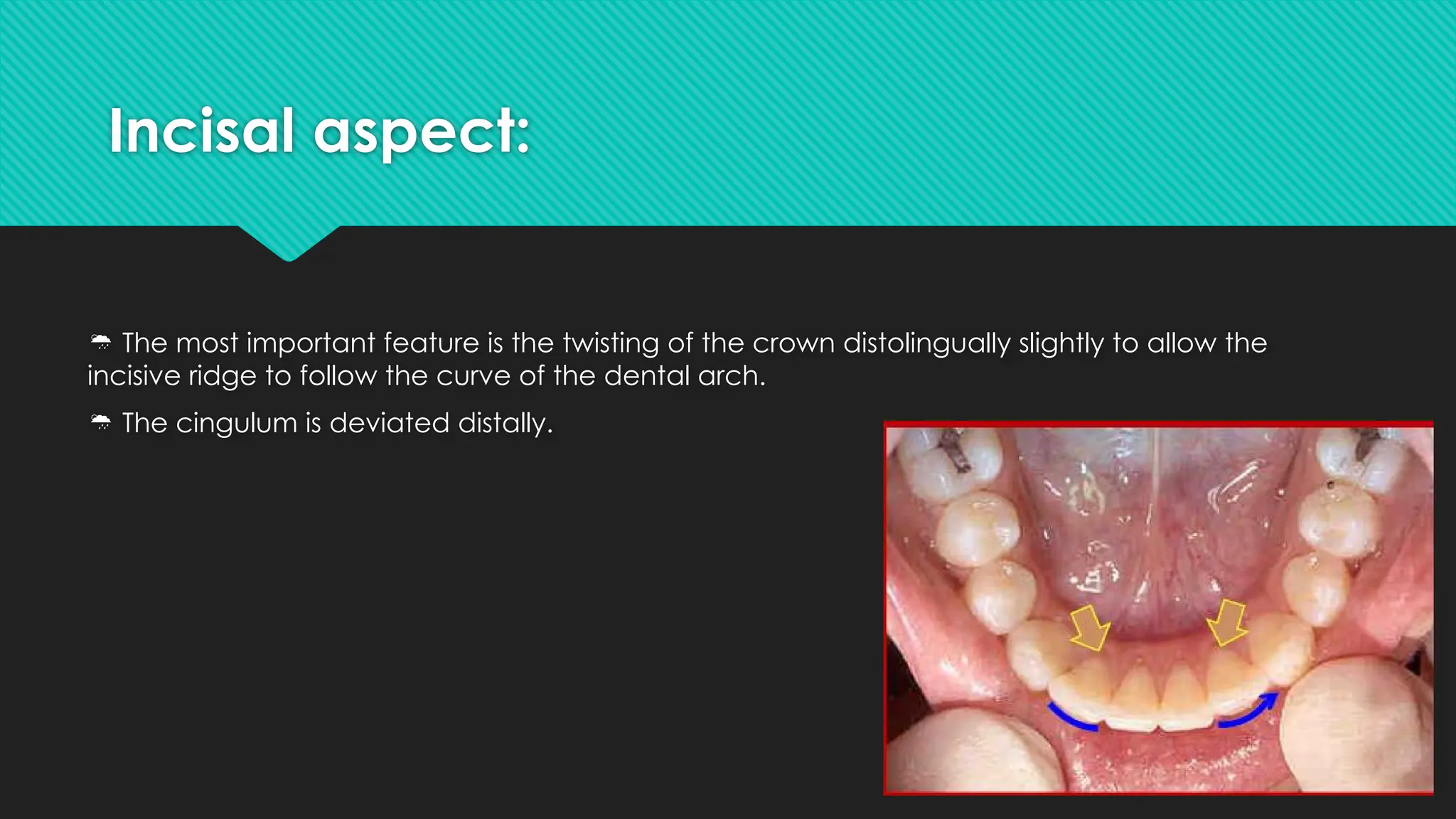 The morphology of permanent mandibular incisors | PPTX