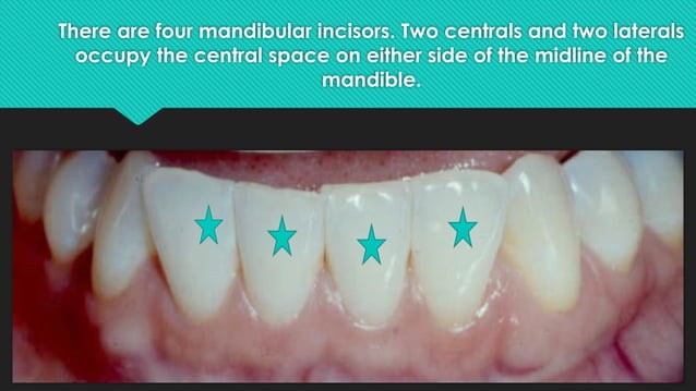 The morphology of permanent mandibular incisors | PPTX