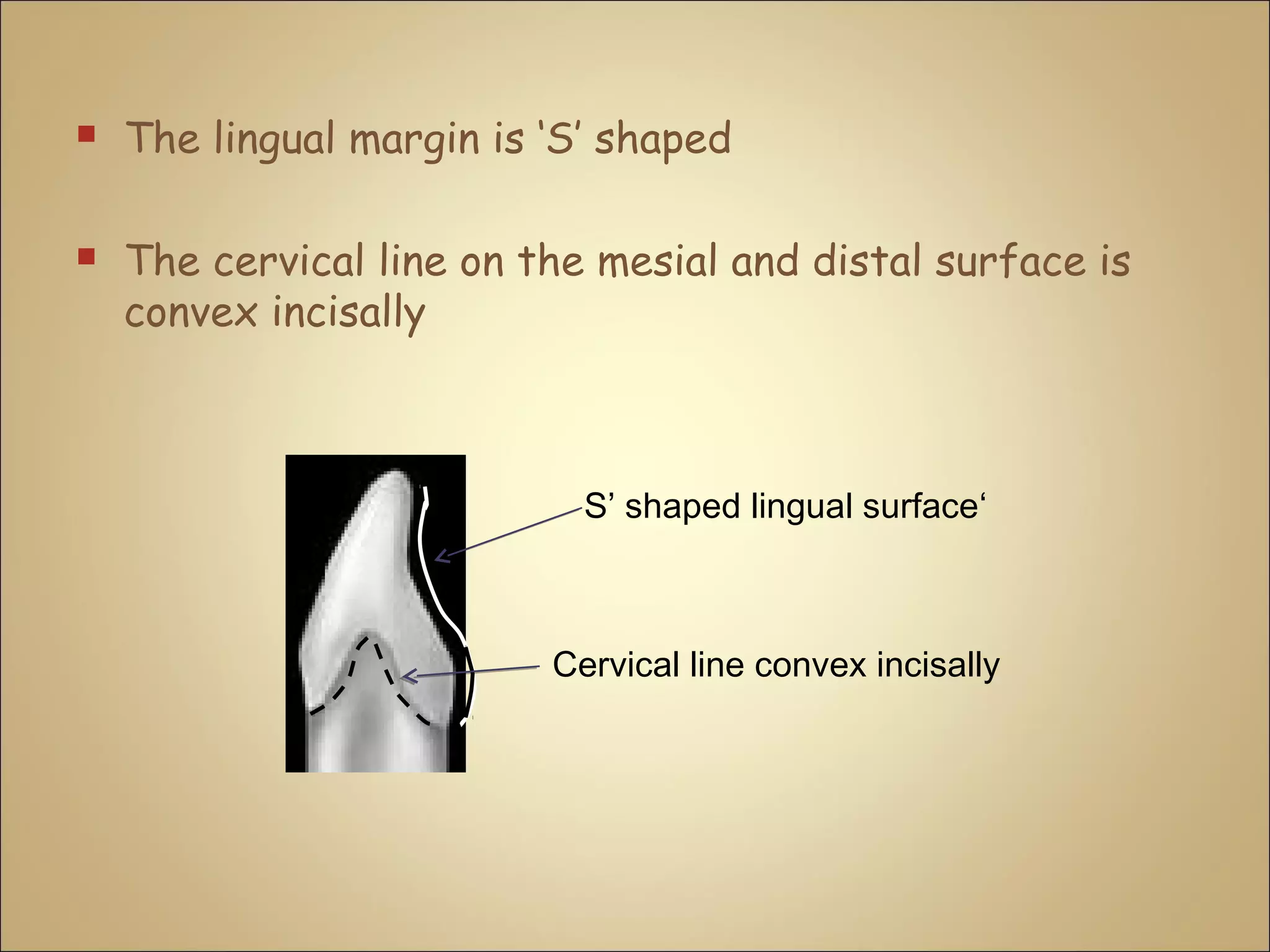 morphology of mandibular central and lateral incisors teeth | PPT