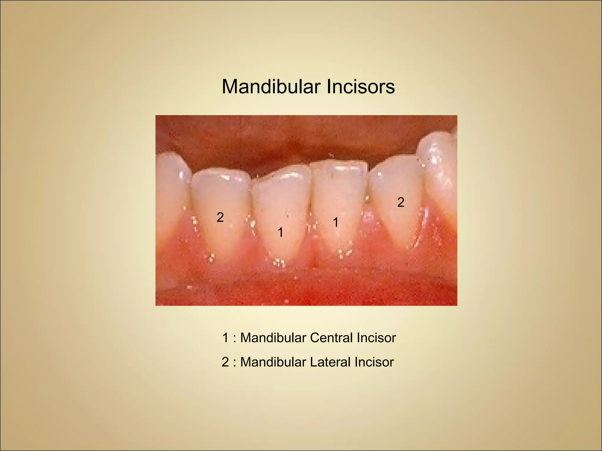 morphology of mandibular central and lateral incisors teeth | PPT ...