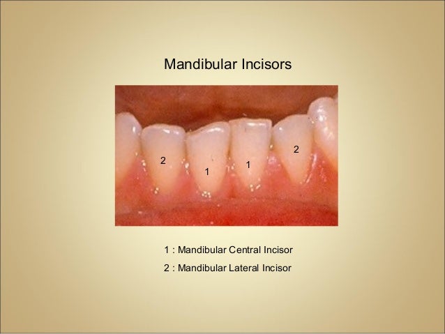 morphology of mandibular central and lateral incisors teeth