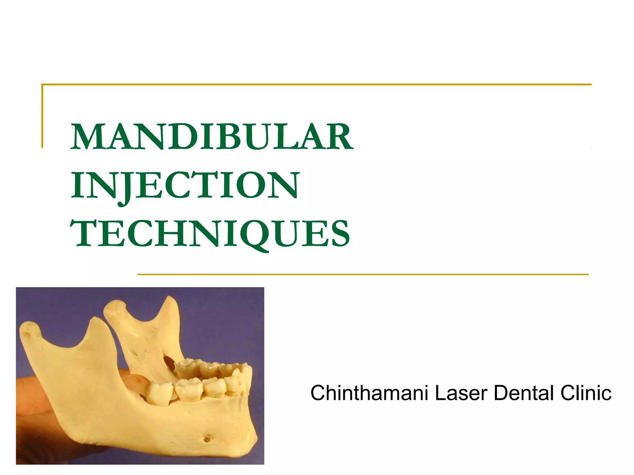 Mandibular Injection Technique | PPT