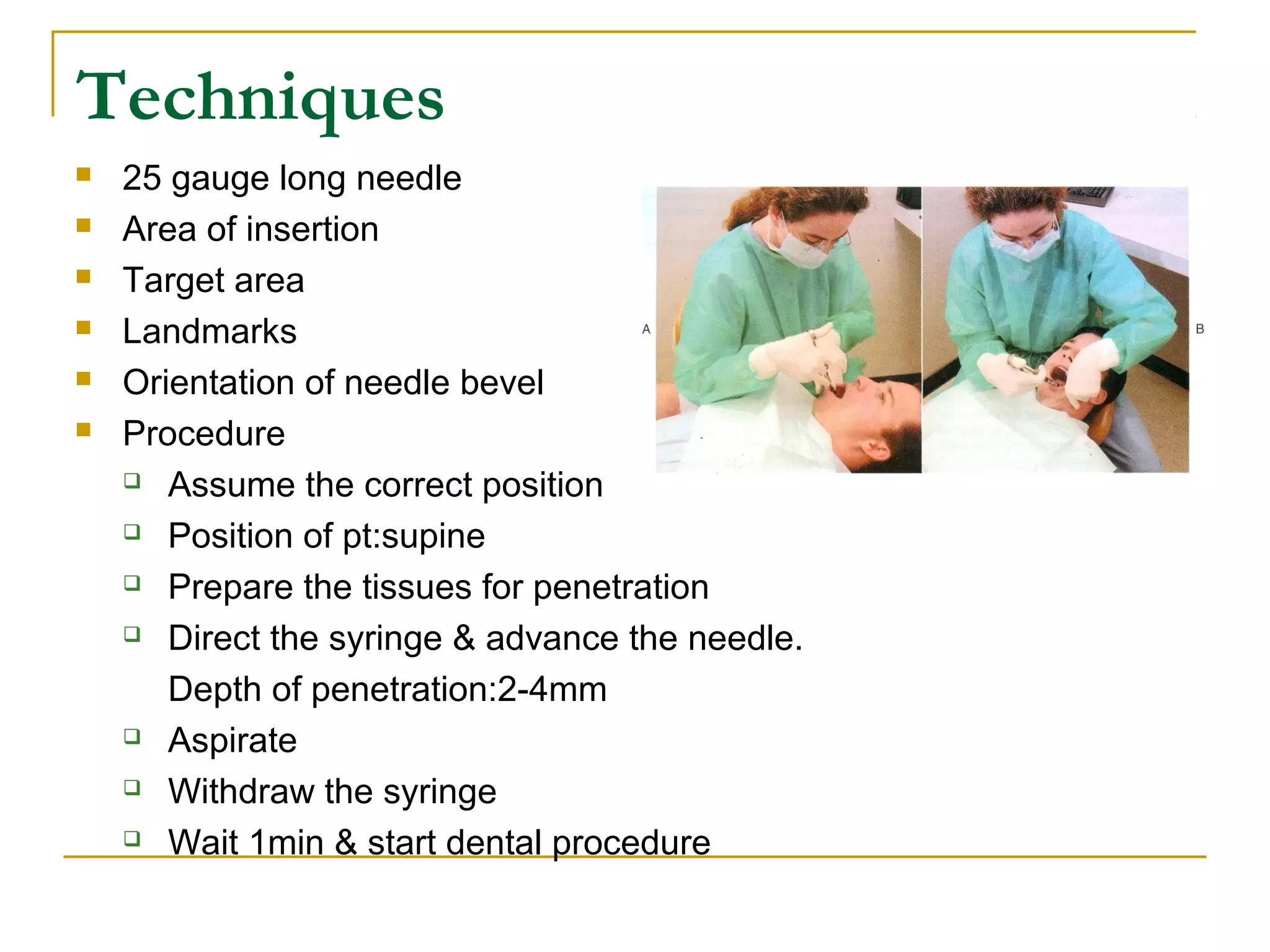 Mandibular Injection Technique | PPT