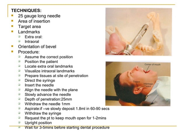 Mandibular Injection Technique | PPT | Ear, Nose and Throat Conditions ...