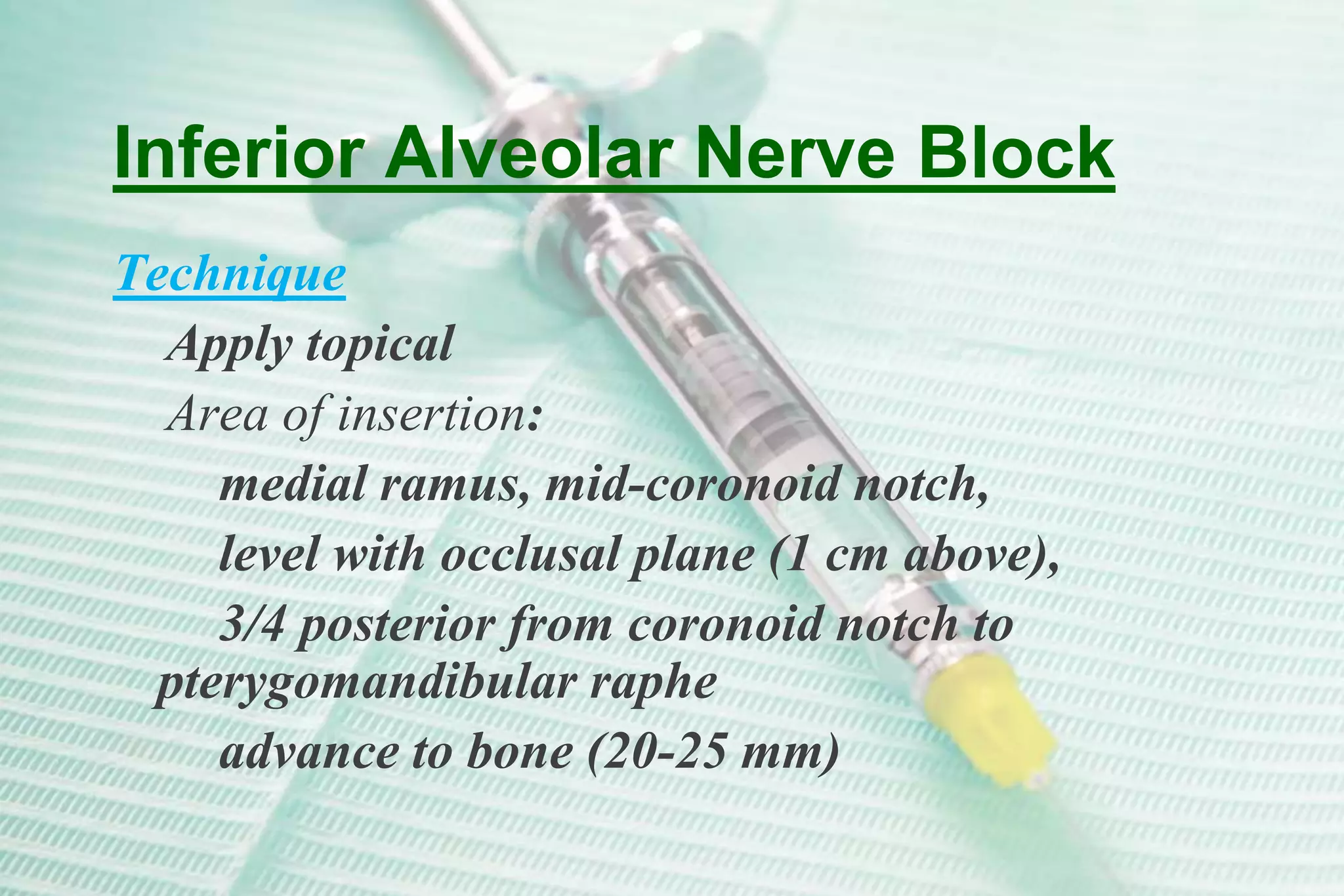 Mandibular injections | PPTX