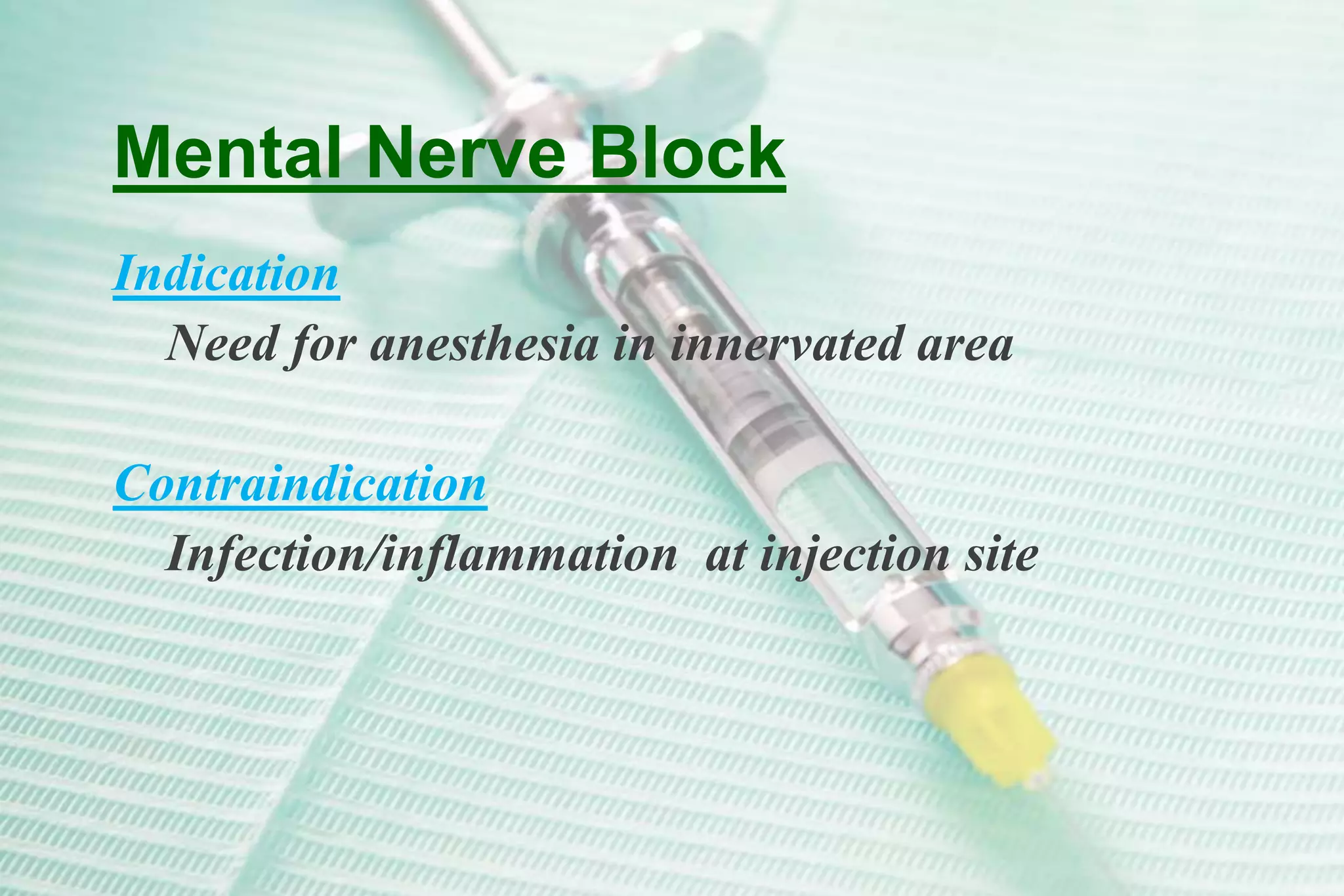 Mandibular injections | PPTX