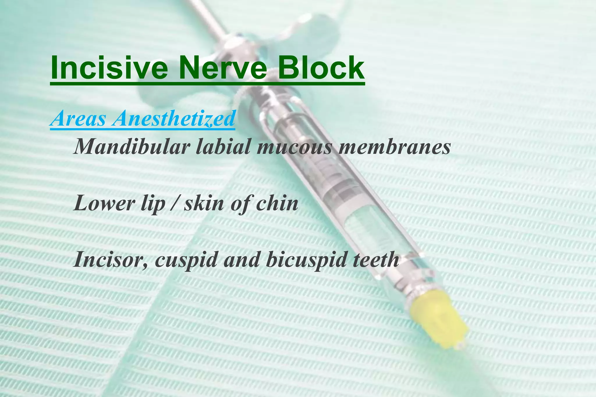 Mandibular injections | PPTX | Ear, Nose and Throat Conditions ...