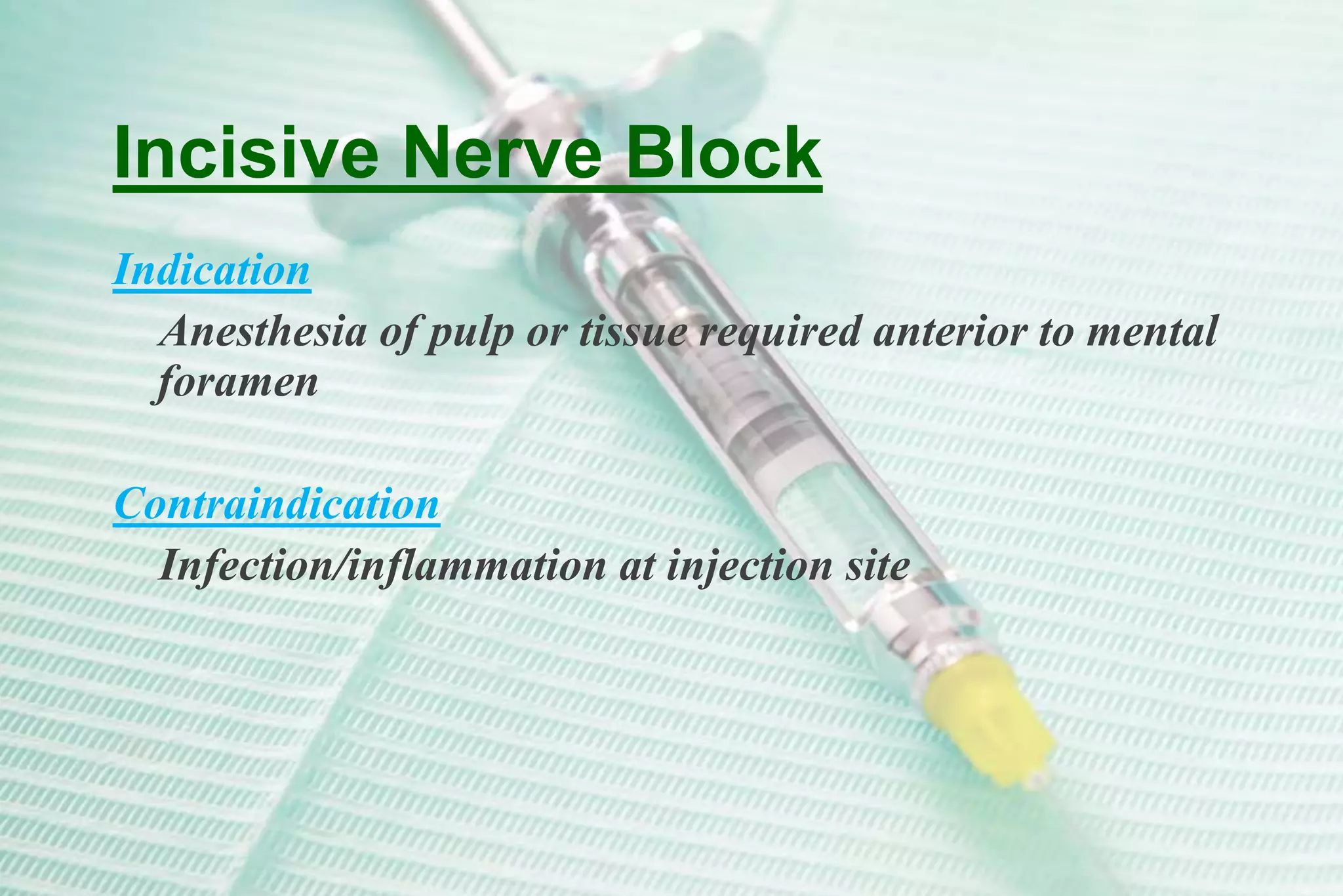 Mandibular injections | PPTX