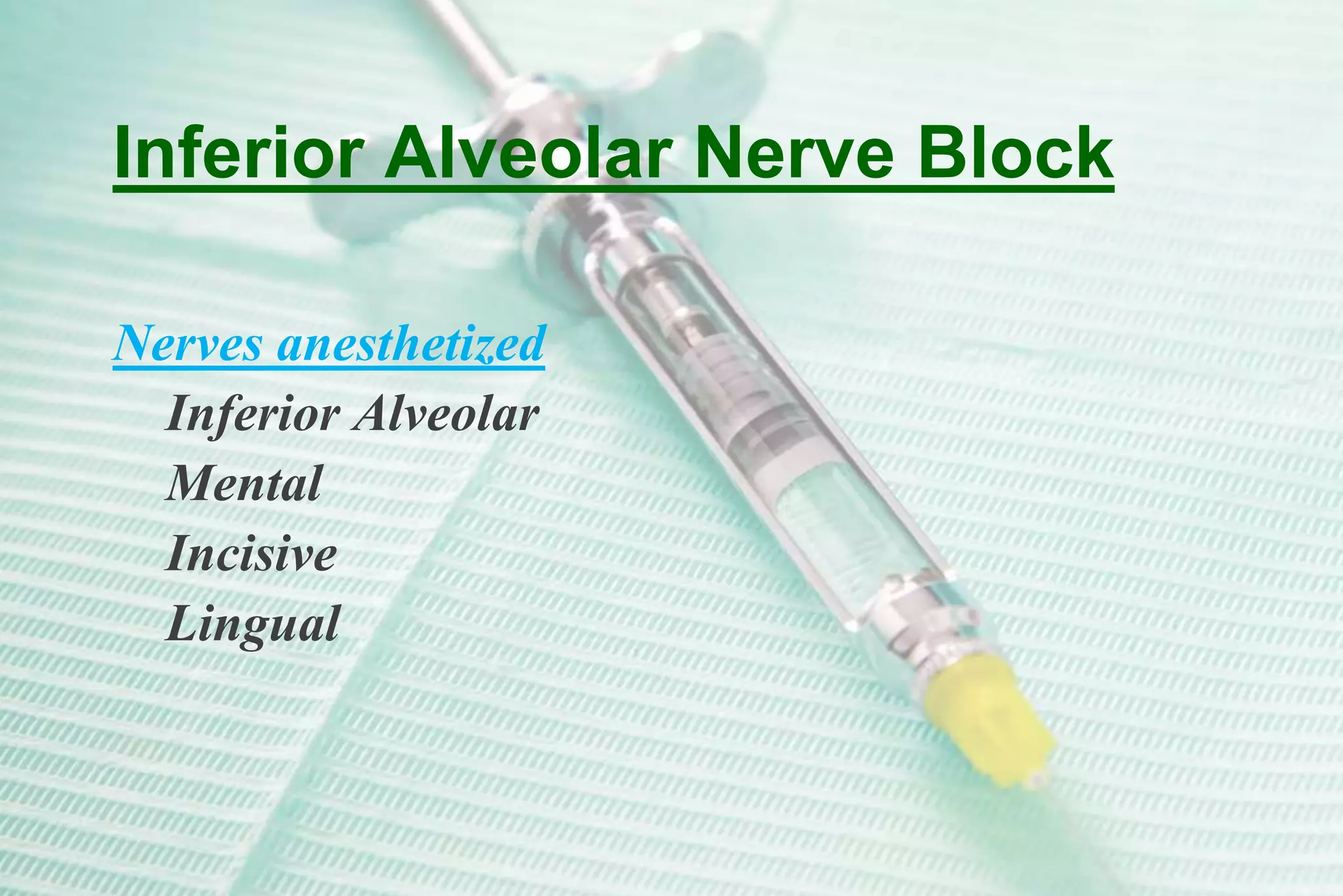 Mandibular injections | PPTX