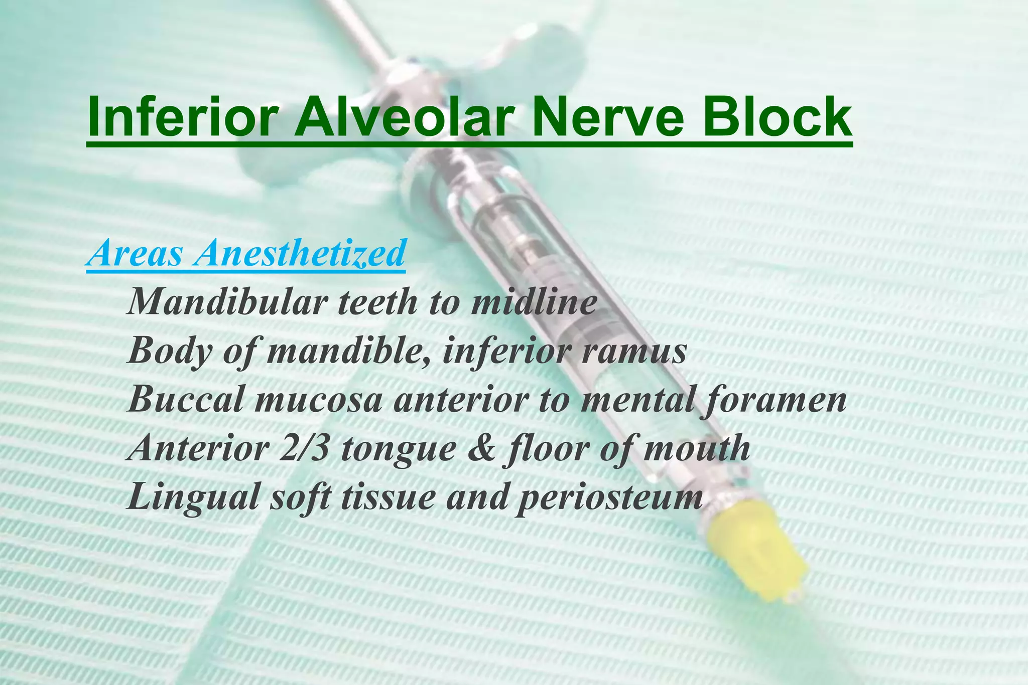 Mandibular injections | PPTX